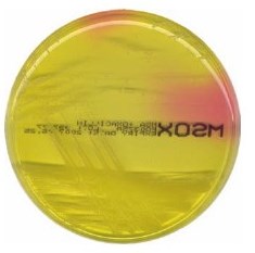 Medios cromogénicos: Bacteriología en color - Bioartis SRL