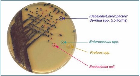 Medios cromogénicos: Bacteriología en color - Bioartis SRL