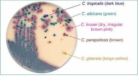 Medios cromogénicos: Bacteriología en color - Bioartis SRL